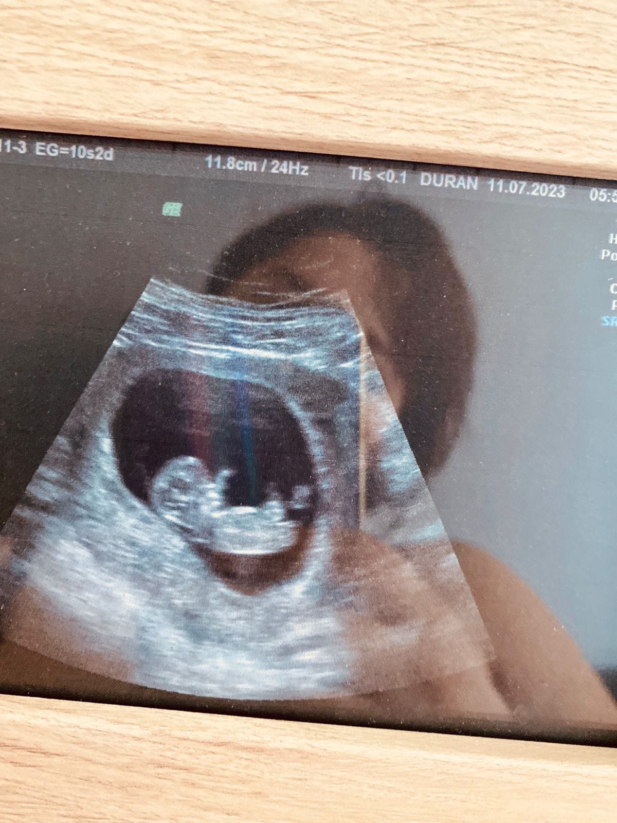 Loving mom - by Elisa Beth - Elisa’s Substack