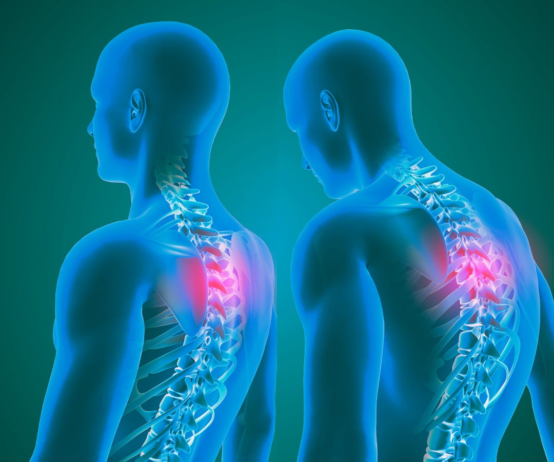 The Vital Role of Posture in Wellbeing.