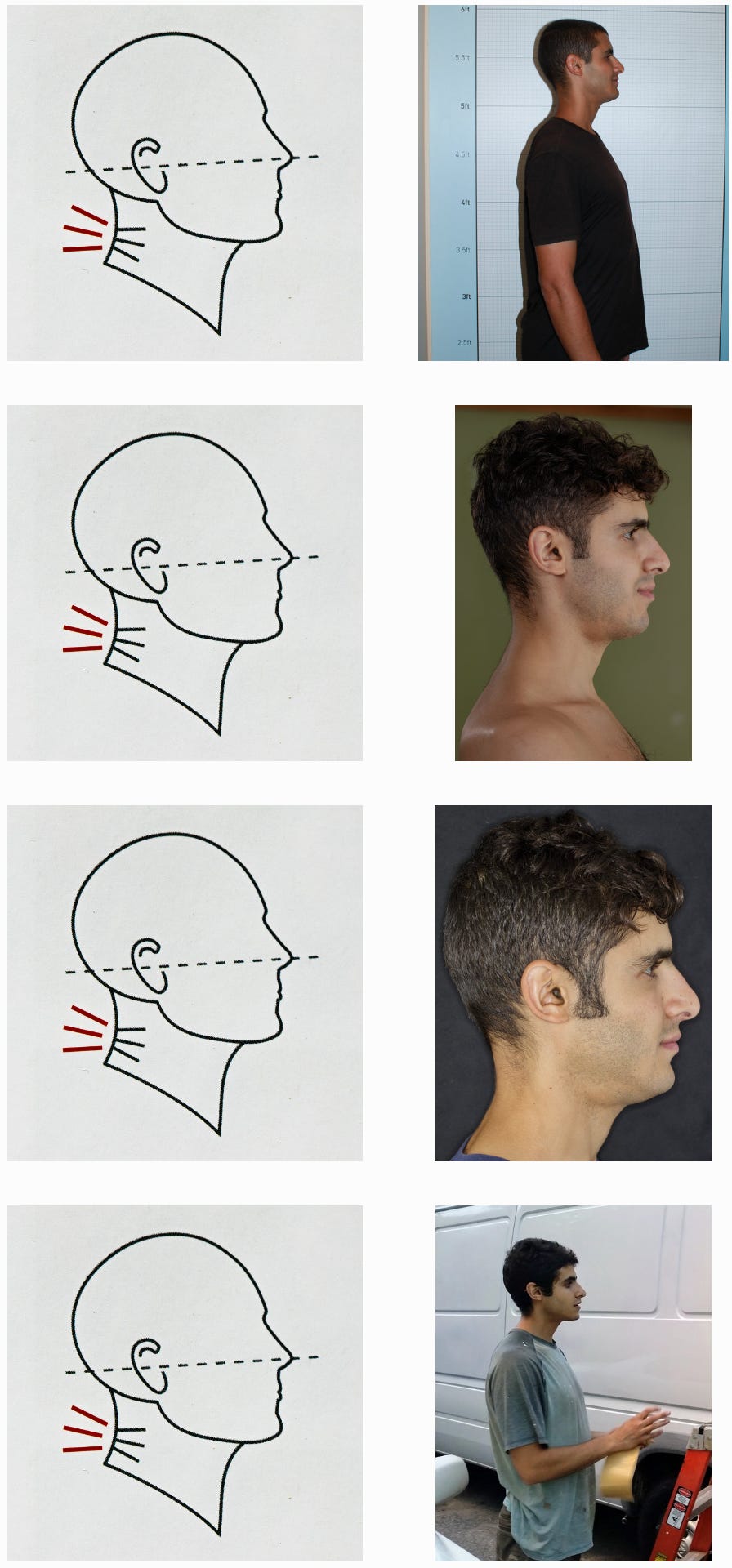 2.3 Mewing is More Than Just Tongue Posture - by Ronald Ead