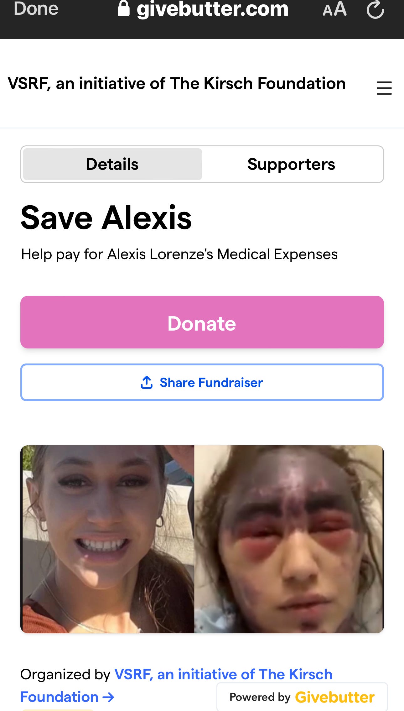 Alexis Lorenze Update - by Dr Margaret Aranda