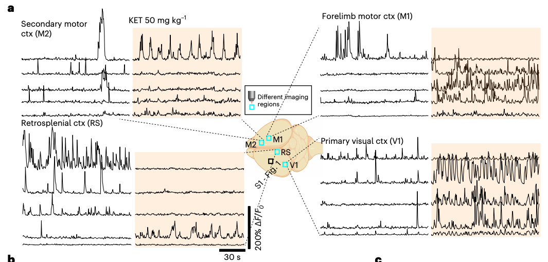 What is Psychological Identity? | Part IV: The Neuroscience of ...