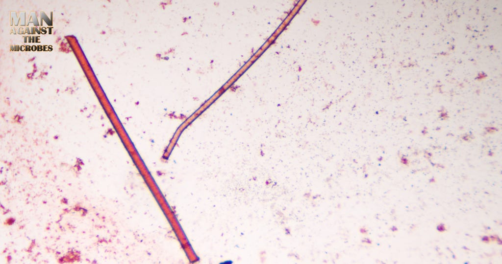DYE techniques are proving to be very useful in analyzing COV swab (RAT ...