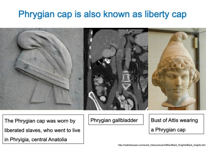 What is a Phrygian (Cap) Gallbladder? - by EndoCollab