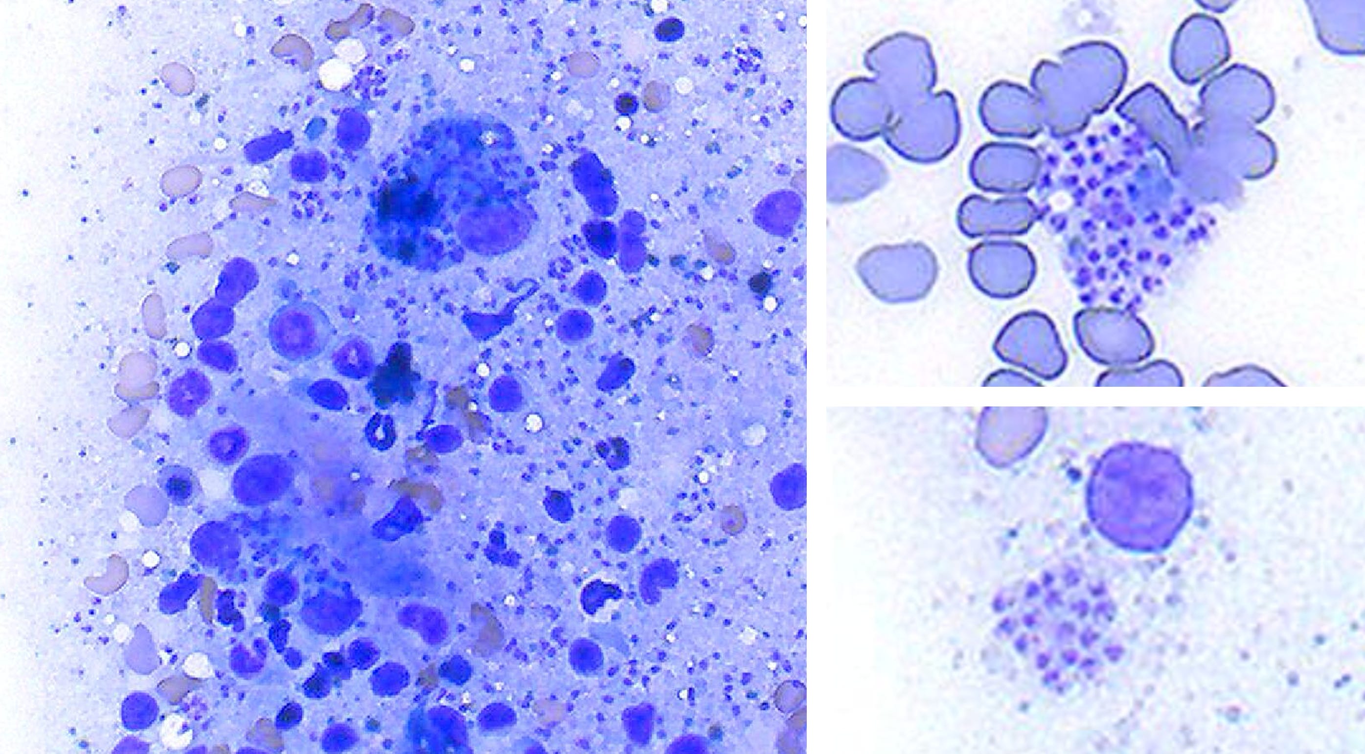 Leishmania is Endemic in the US - by Eric Fish, DVM, PhD