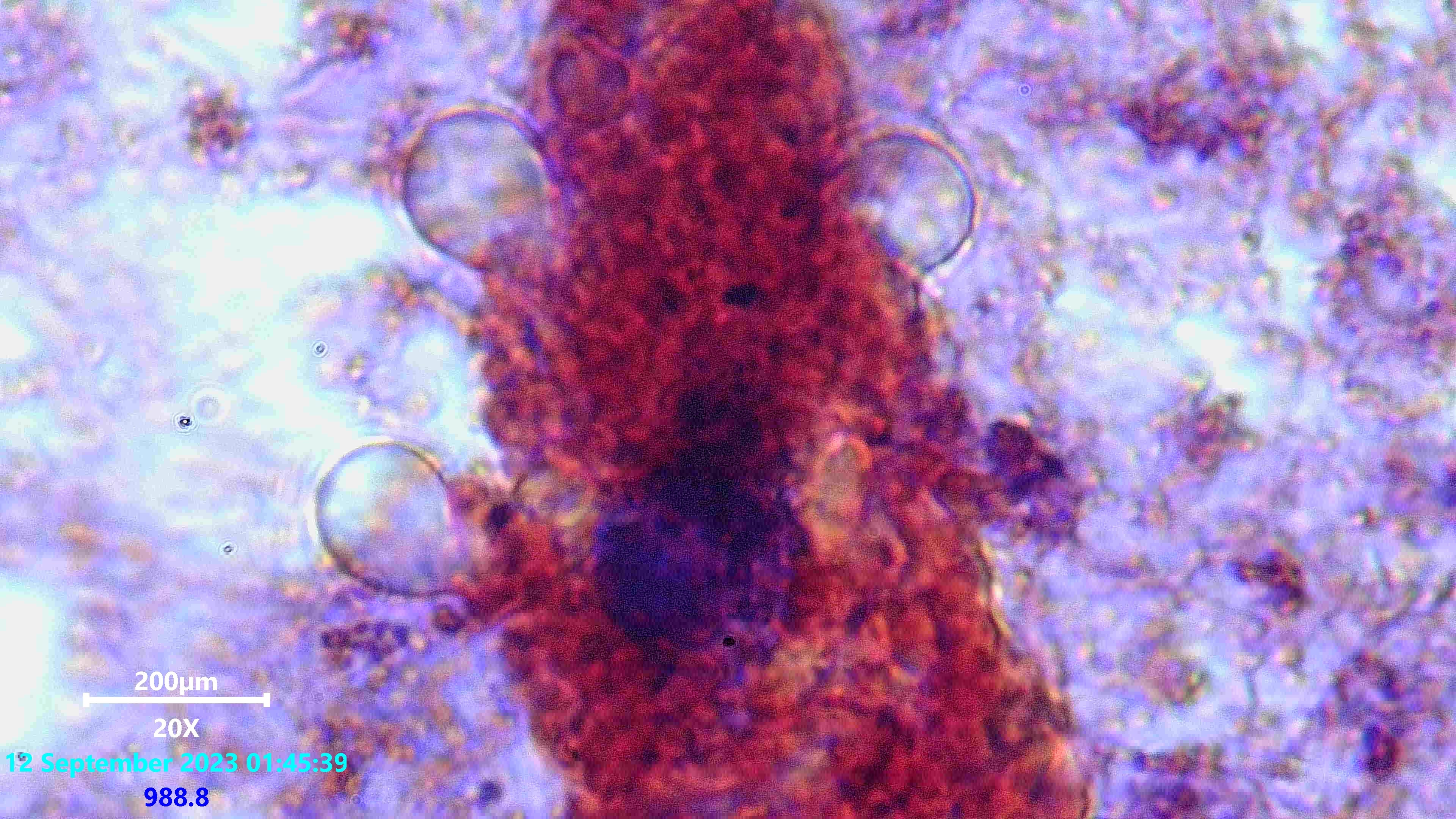 Gram staining of my blood reveals same abnormalities shown by ...
