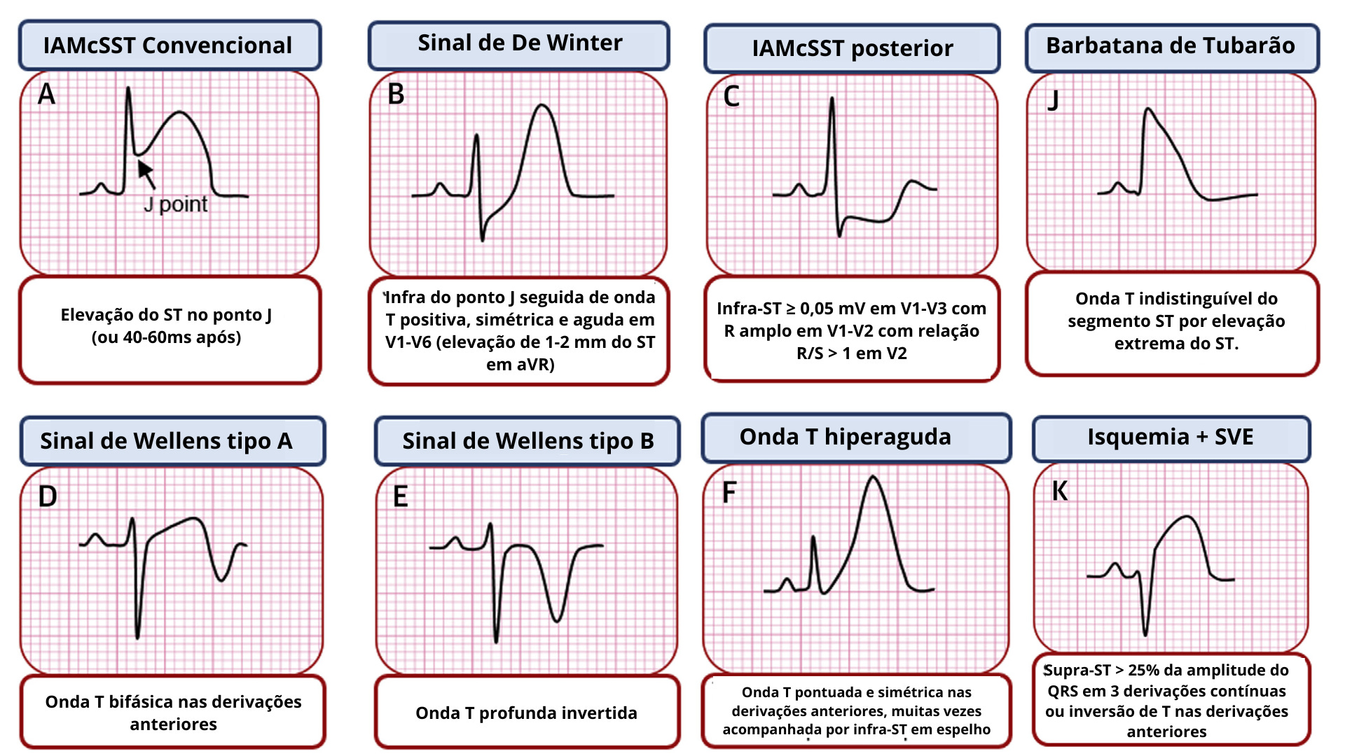 Dor torácica no pronto-socorro (PS)
