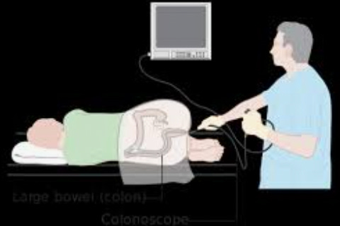The 19 Stages of Your Colonoscopy - by Catherine Newman