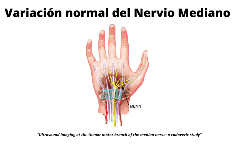 Anatomía Del Nervio Radial