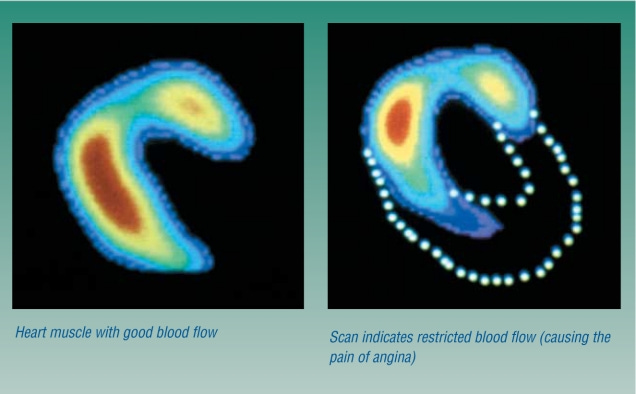 Nuclear medicine: 18F-FDG PET/CT for the detection of vaccine-induced ...
