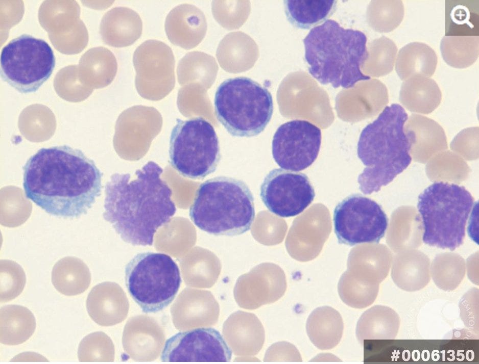 Blood Smear of the Day (3/8/23)