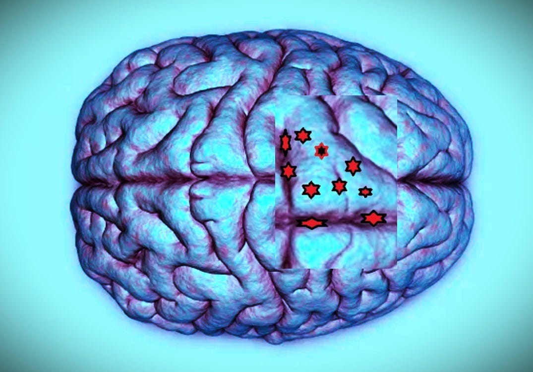 Dr. Senna Grows a Second Head (2) - by Vidas Mickevicius