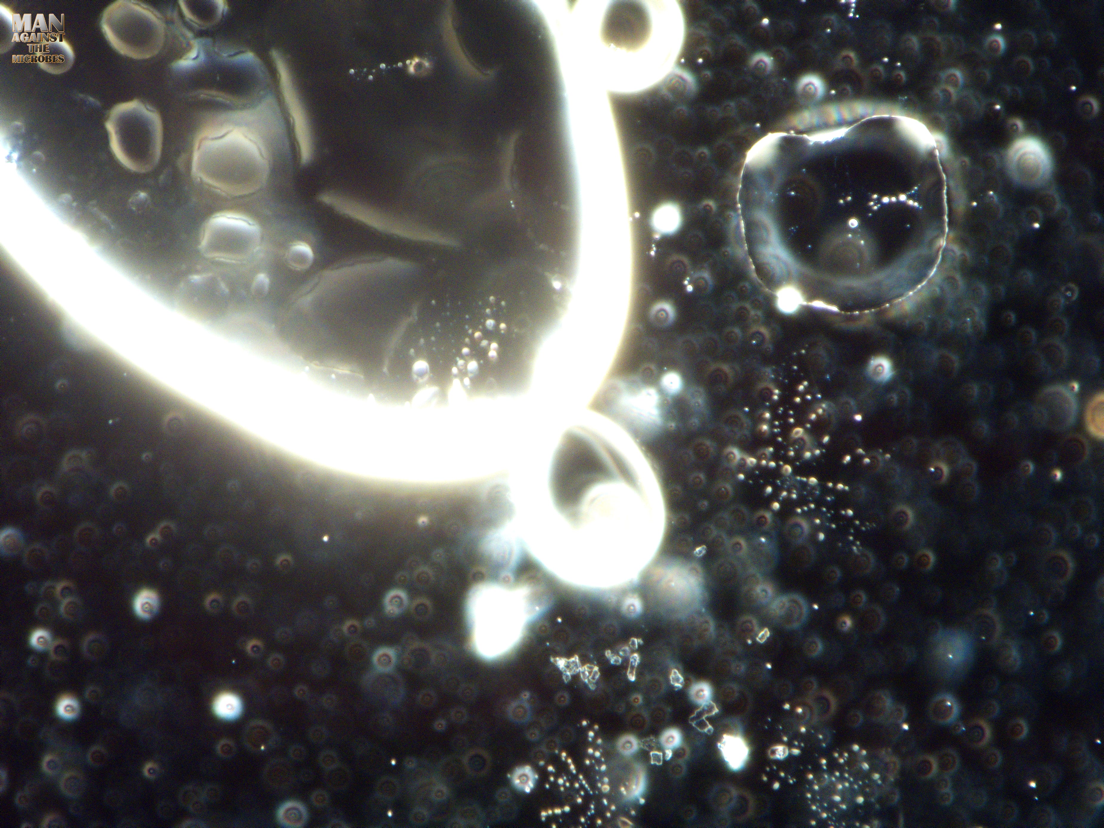 Bubbles In Blood Are Possibly Part Of An In Vivo Microfluidic System