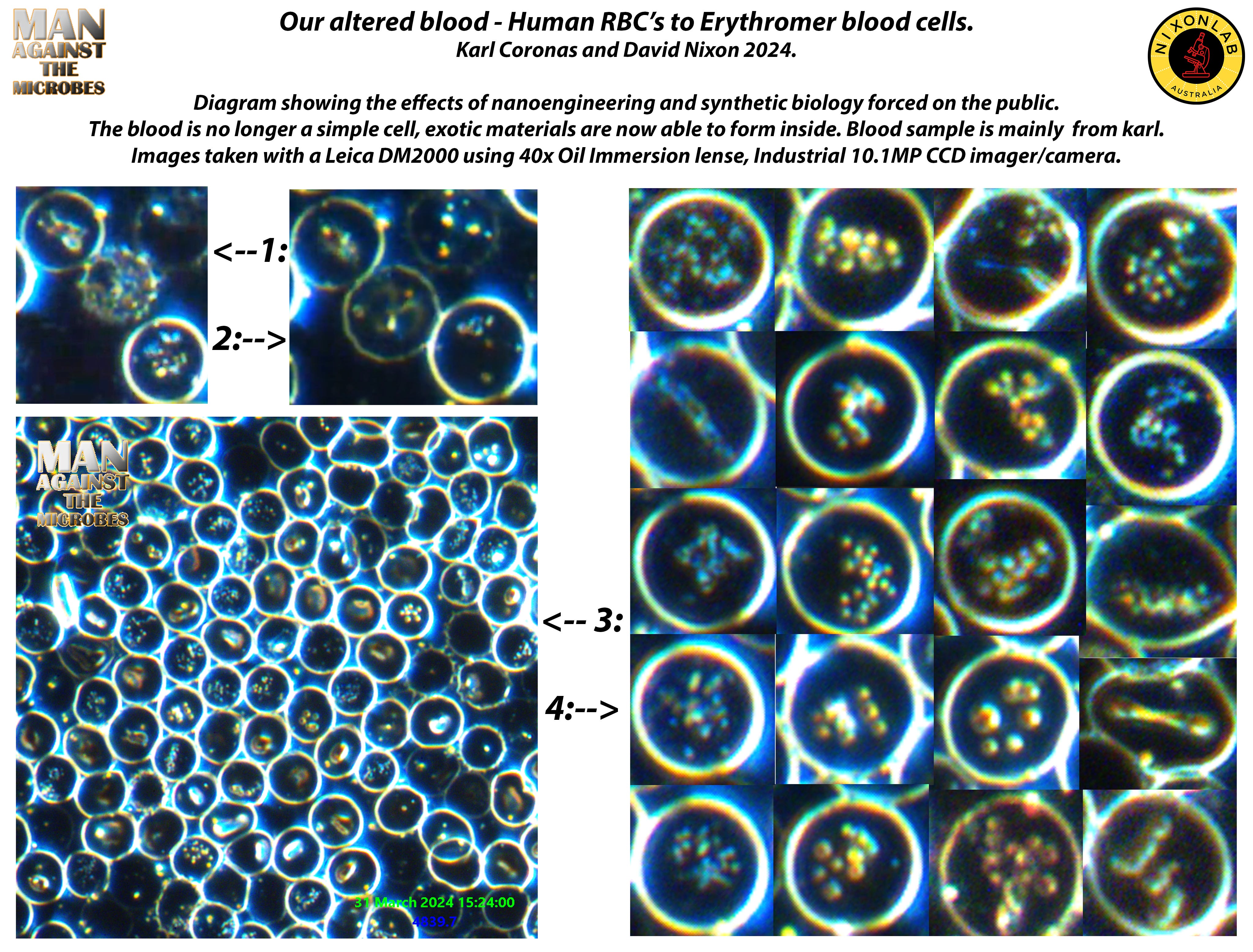 The process of altering our blood cells. See an Erythromer form in this ...