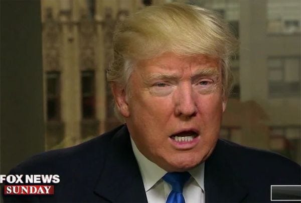 Donald Trump's Gigantic Brain Doesn't Need Intelligence