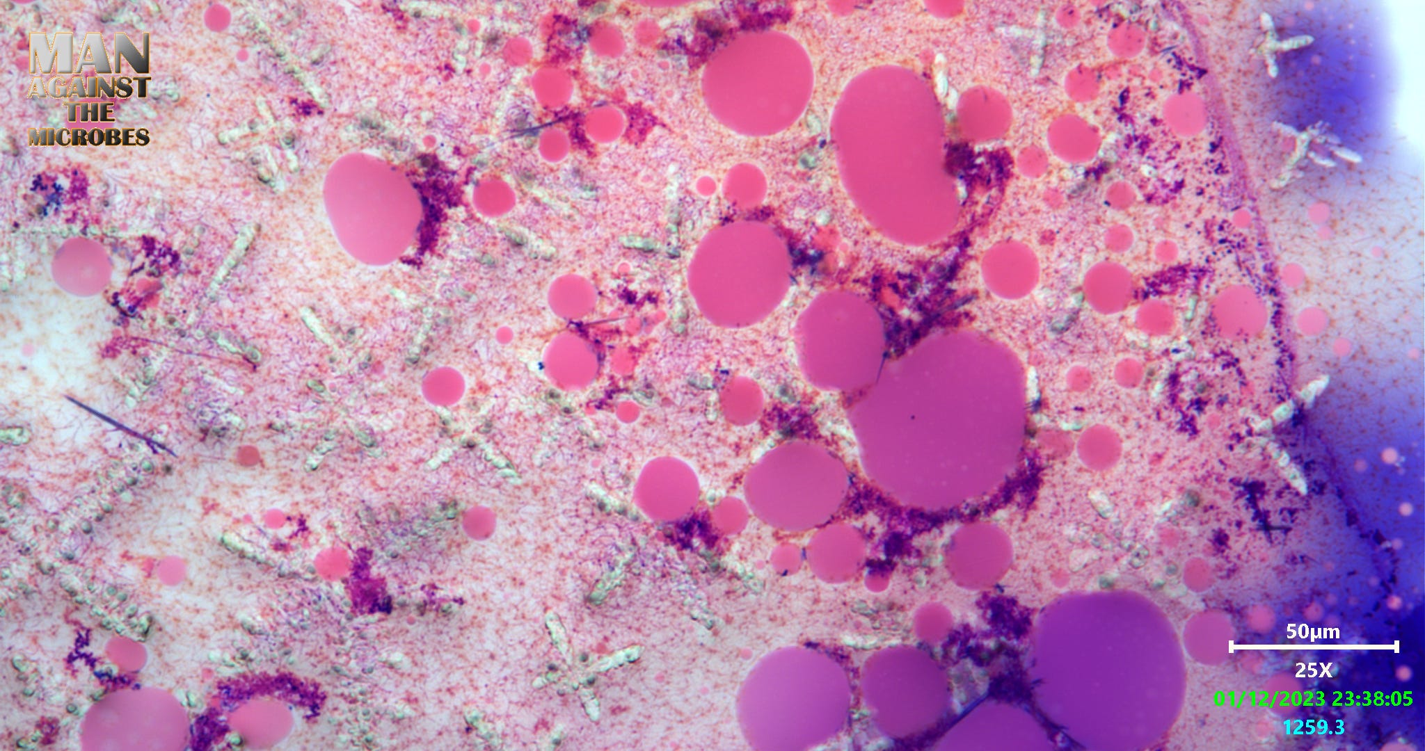 WoW! Staining of the swab solution show amazing chemical transitions ...