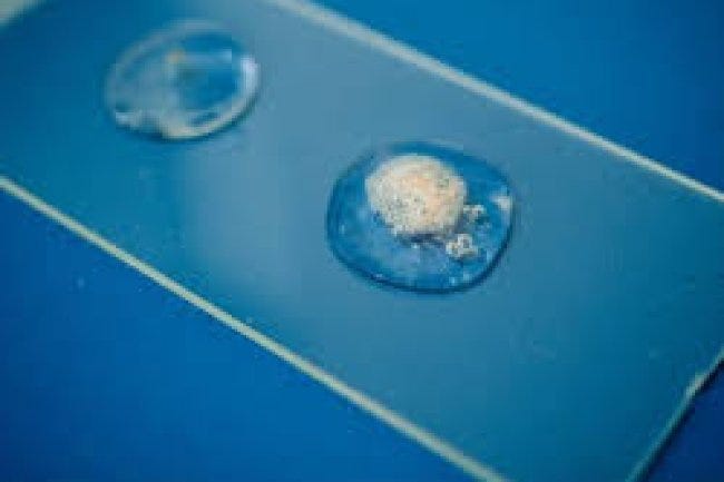 Catalase Test- Principle, Procedure, and Result Interpretation.