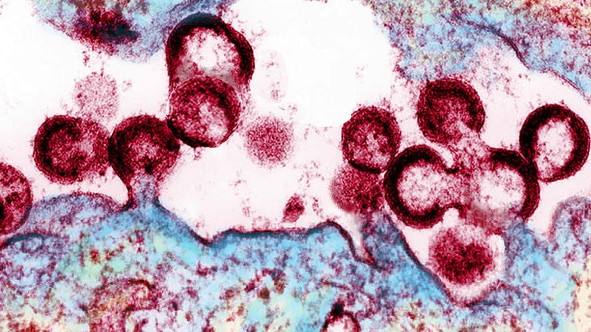 Science Falls Behind as Syphilis Stages Another Comeback