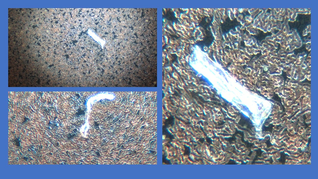 ANA MARIA MIHALCEA, MD, PHD: "Complete Resolution Of "Long Covid ...