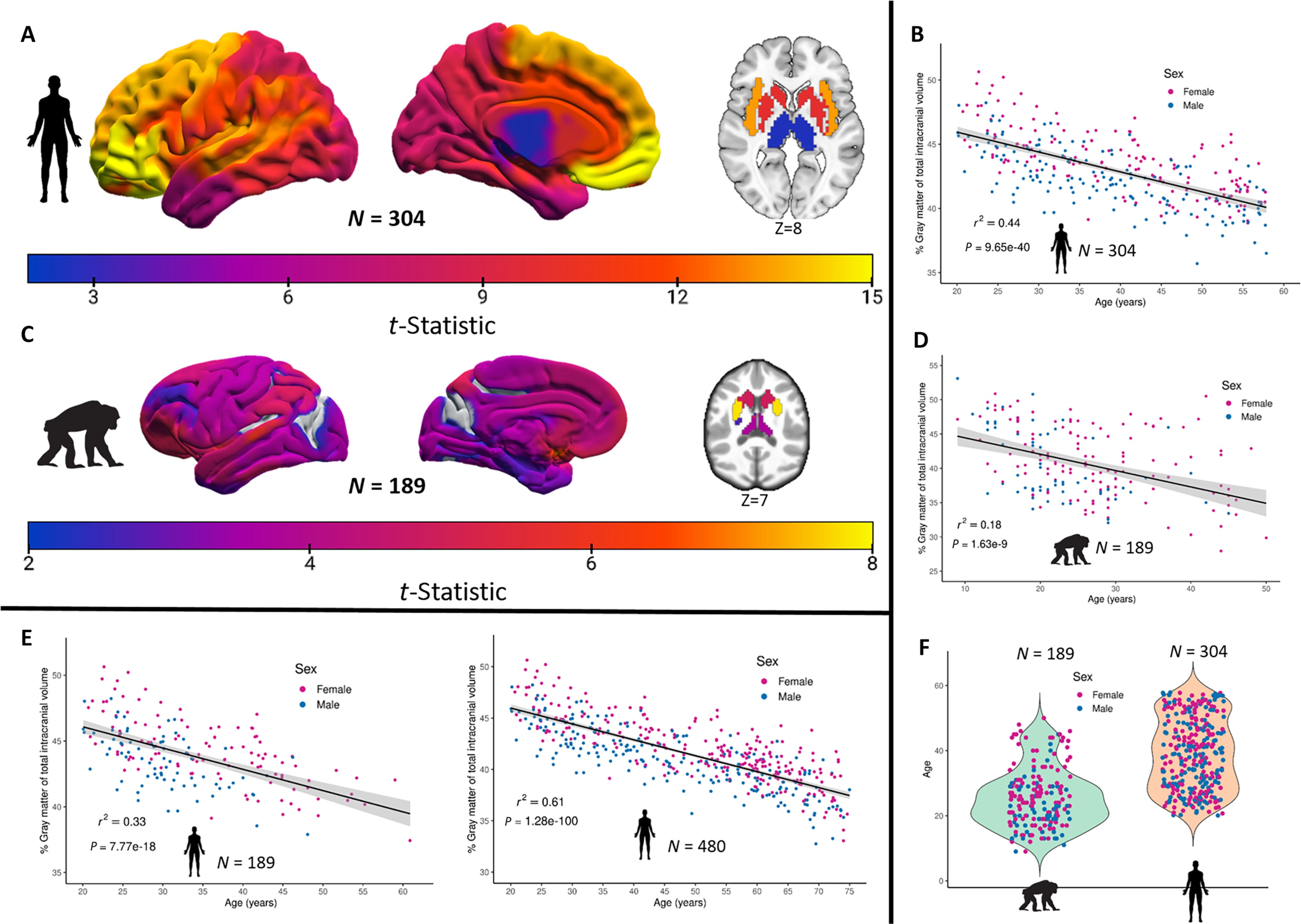 The Evolutionary Trade-Off: How Human Brain Expansion Leads to ...