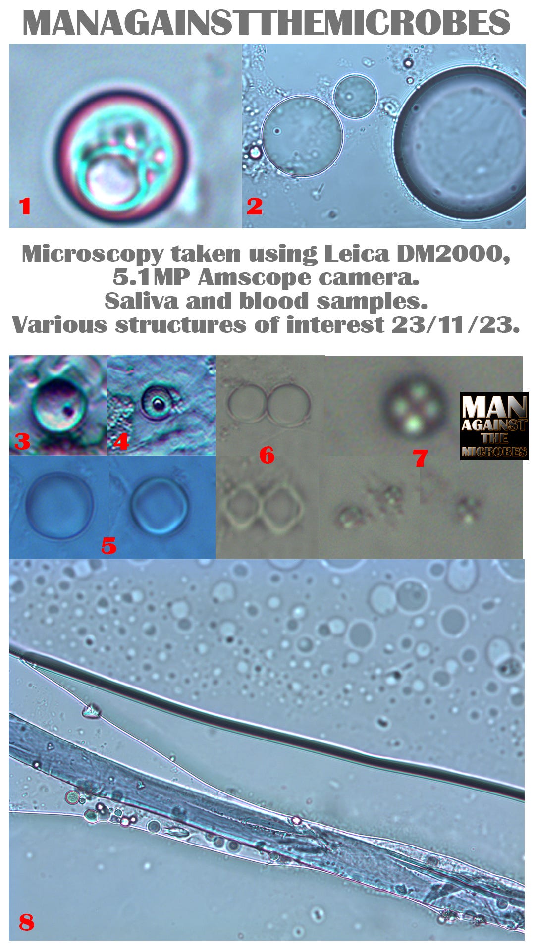 THEORY IN PROGRESS ! Synthetic biology. Protocells/Microcapsules are ...