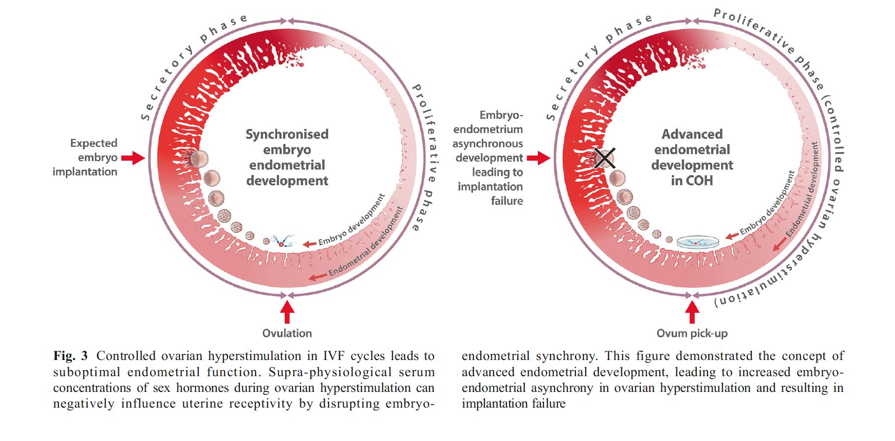 The Fine-Tuning Argument for Embryo-Endometrial Synchrony