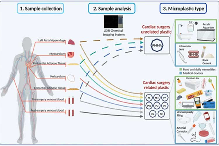 Microplastics May Be Harming Your Body and Brain