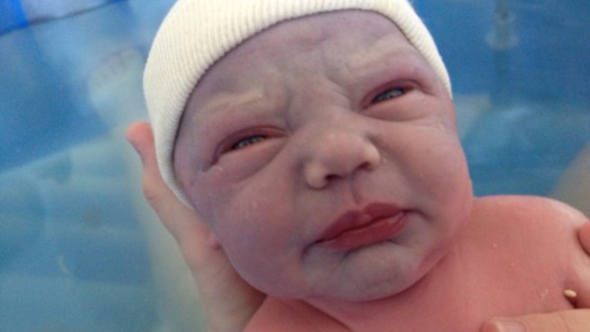 Pediatric Pearls. Infant's Skin: More Color Variations