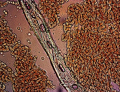 The Source of Blood Coagulation: Cross Domain Bacteria (CDB)