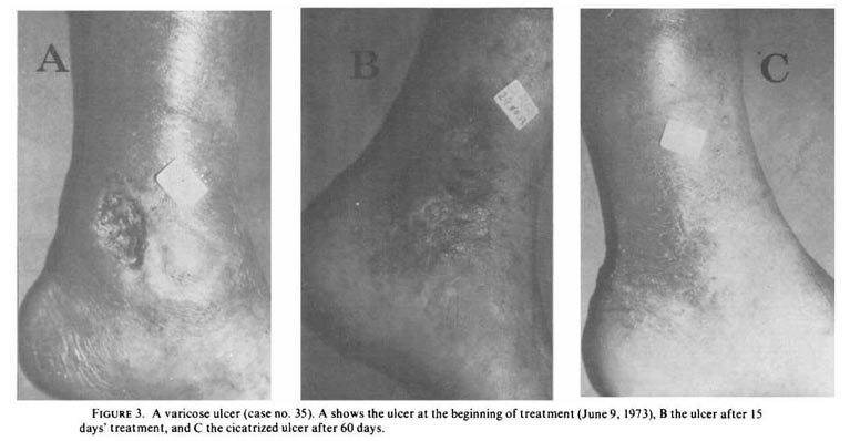 How DMSO Revolutionizes Skin Care and Dermatology