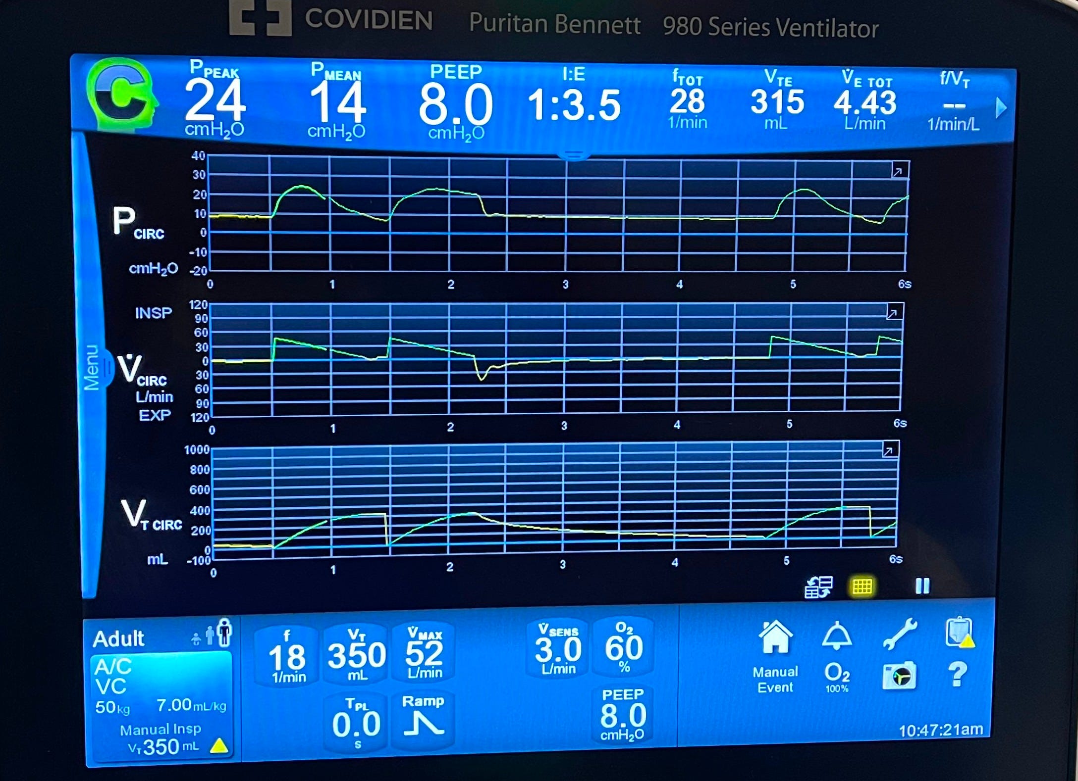 Mechanical Ventilation Made Simple: 9 Concepts Every Non-ICU Doc Should ...