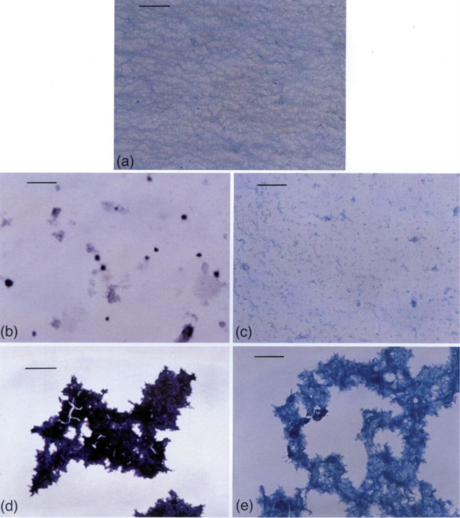 Mucus and Aluminium - by Dr Christopher Exley