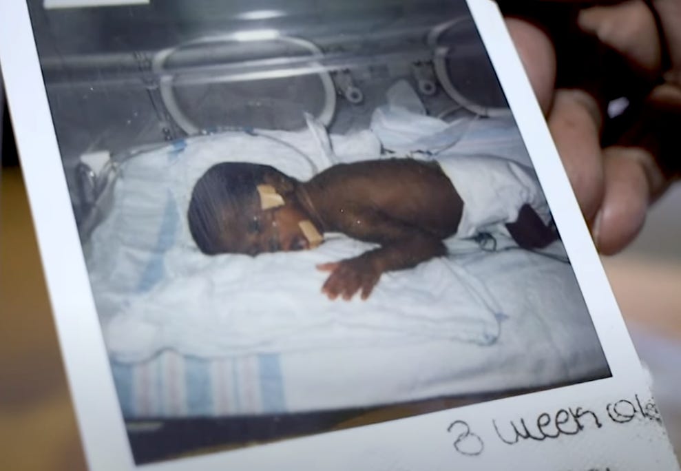 Derick Hall's 'miracle' is far from a finished story