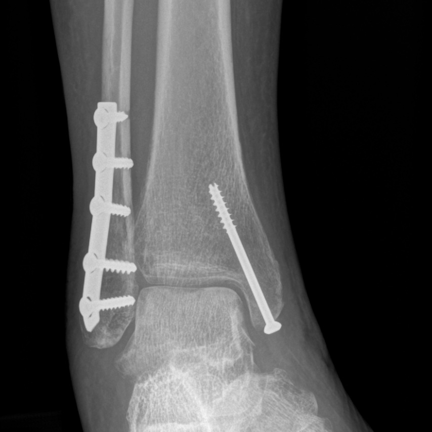 Orthopedic Hardware - Part 1 - by Alexander Baxter