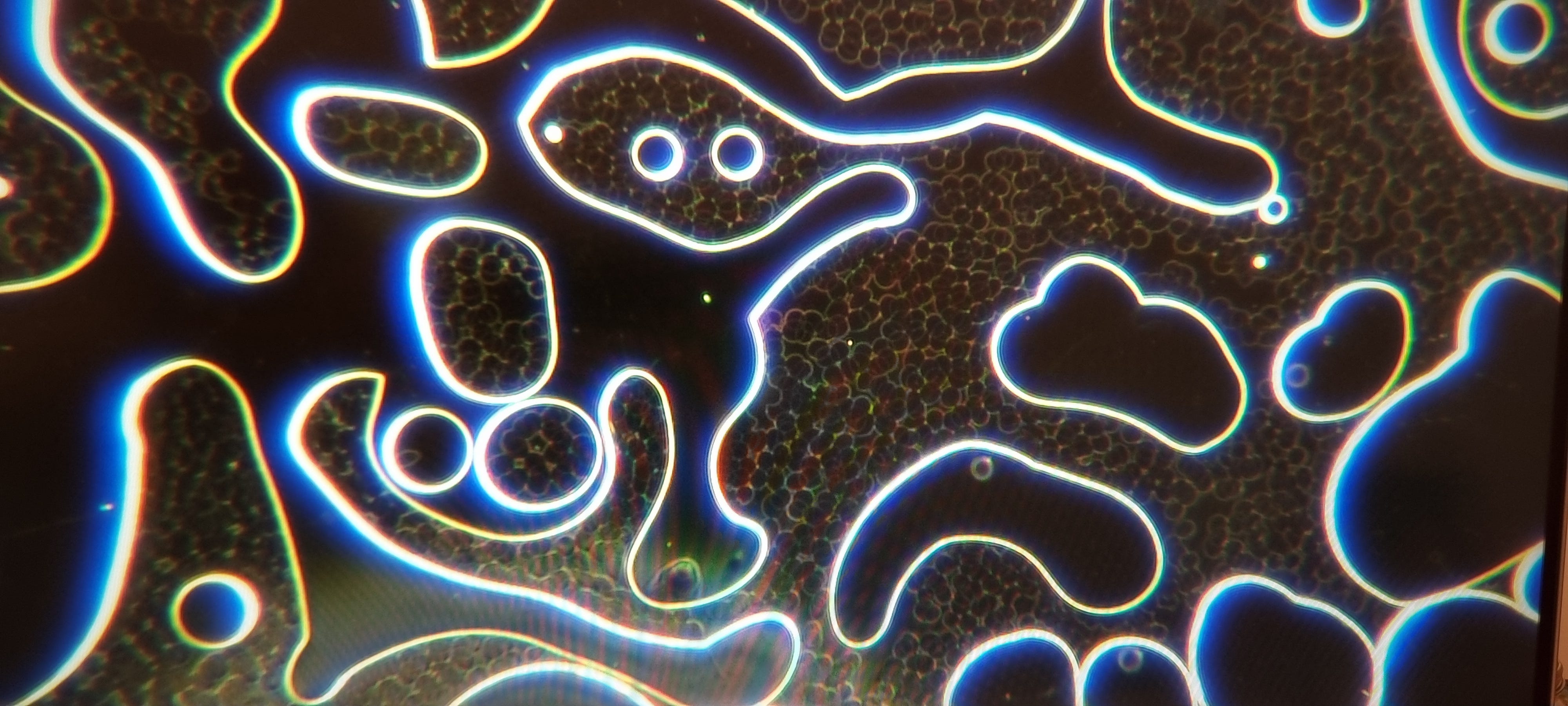 Exploding gel bubbles and WBC's, Glaucoma meds, bot breath and sundry.