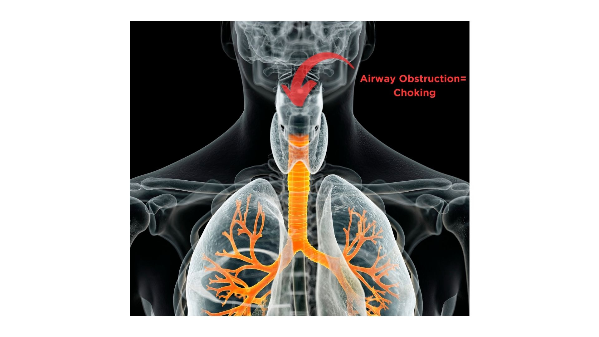The Dangers of Erotic Choking - by Dr. Amber Hull