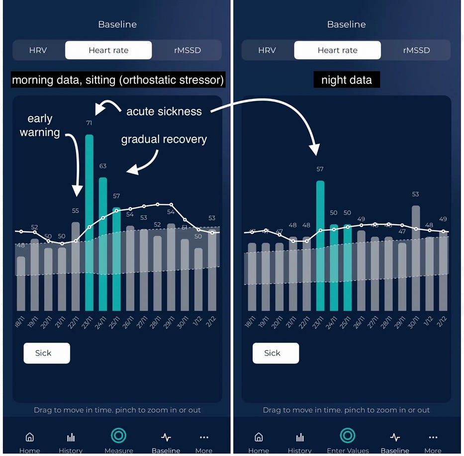 How Should You Measure Your Morning Heart Rate Variability? (HRV)
