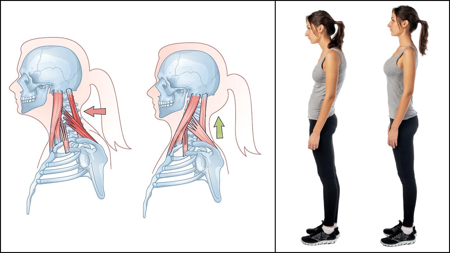 2.3 Mewing is More Than Just Tongue Posture - by Ronald Ead