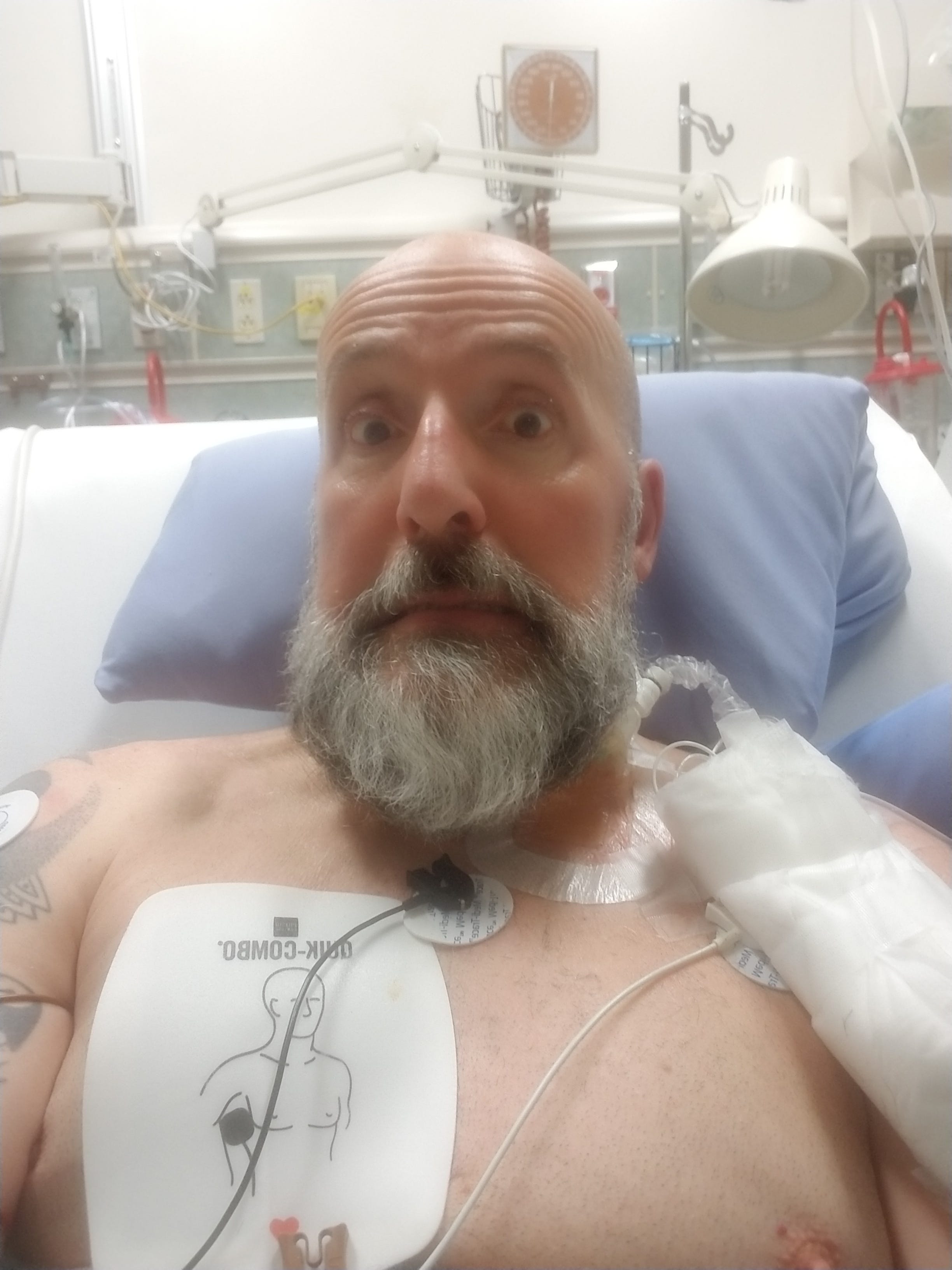 Code Blue, Code Blue - by John Landry - John’s Corner