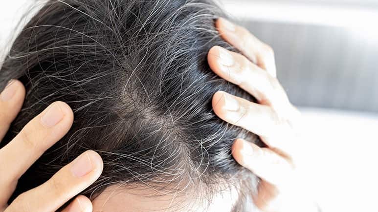 Prematurely Gray? This Is Probably Why