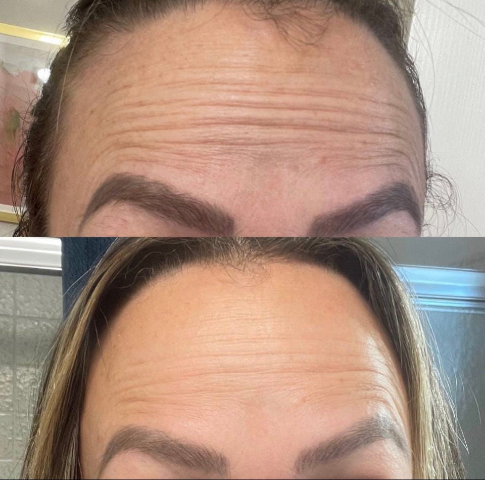 Natural Botox in a Bottle - by Heather Queiroz - GenX Girl