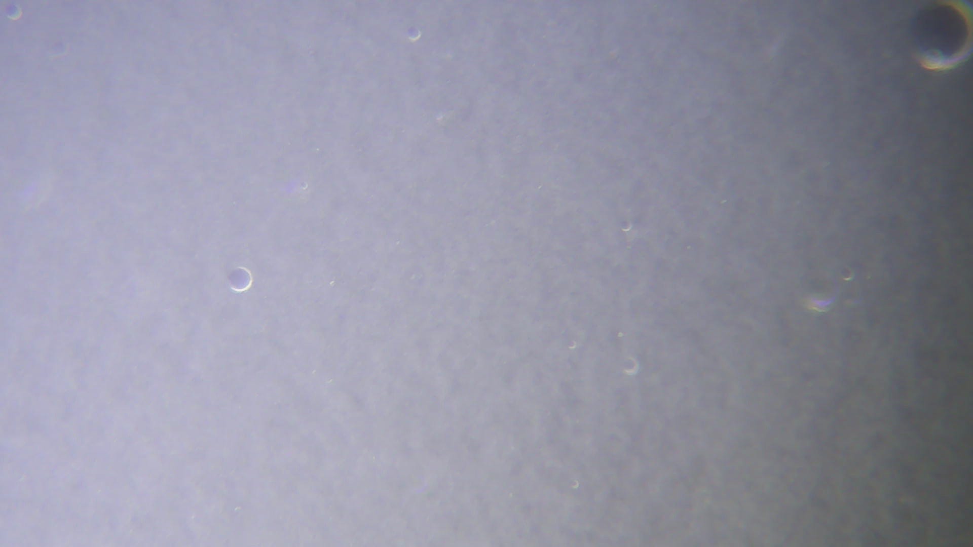 Microscopy of Eggs from Our Chickens