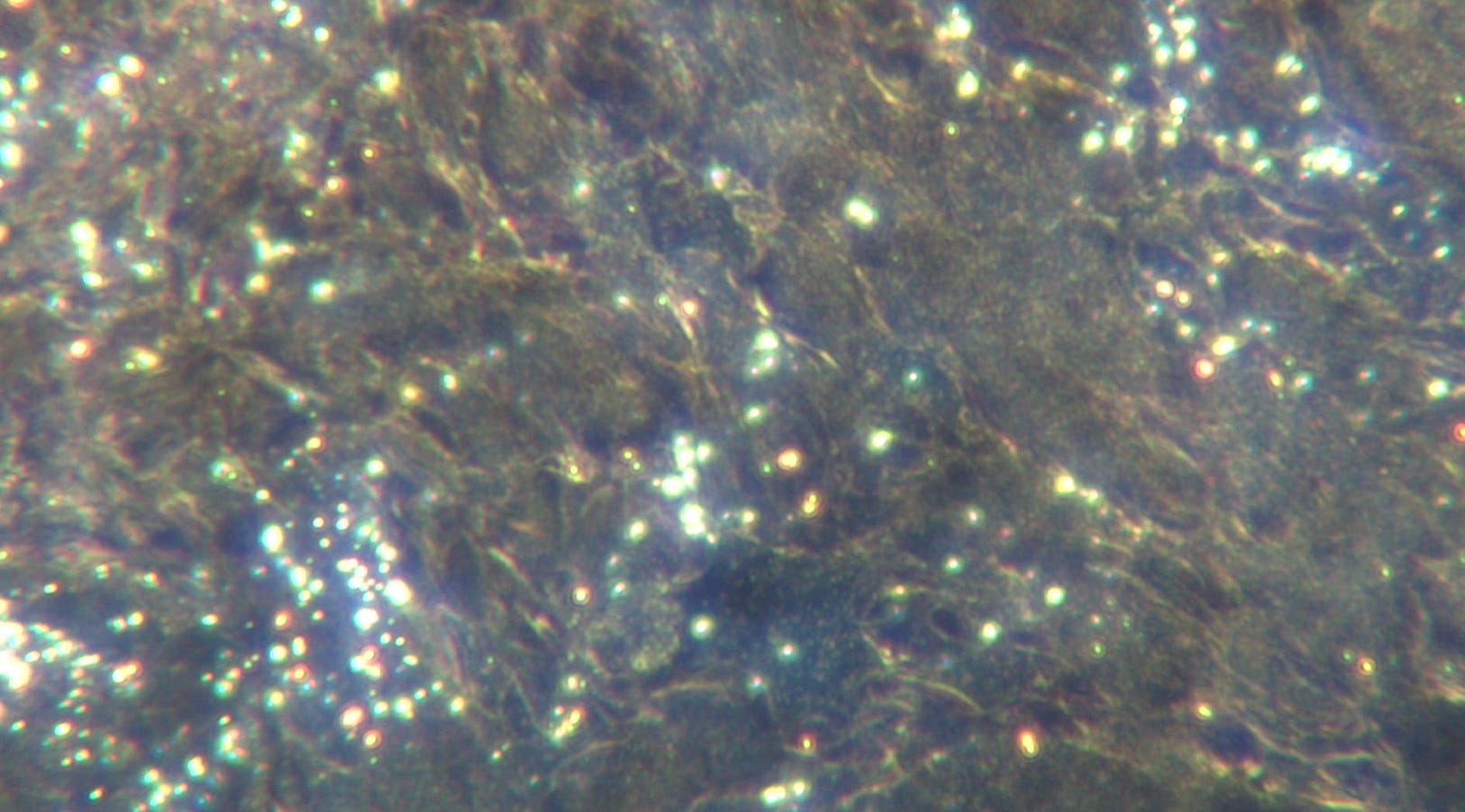 Darkfield Live Blood Microscopy Of A Discoid Mesogen Self Assembly ...