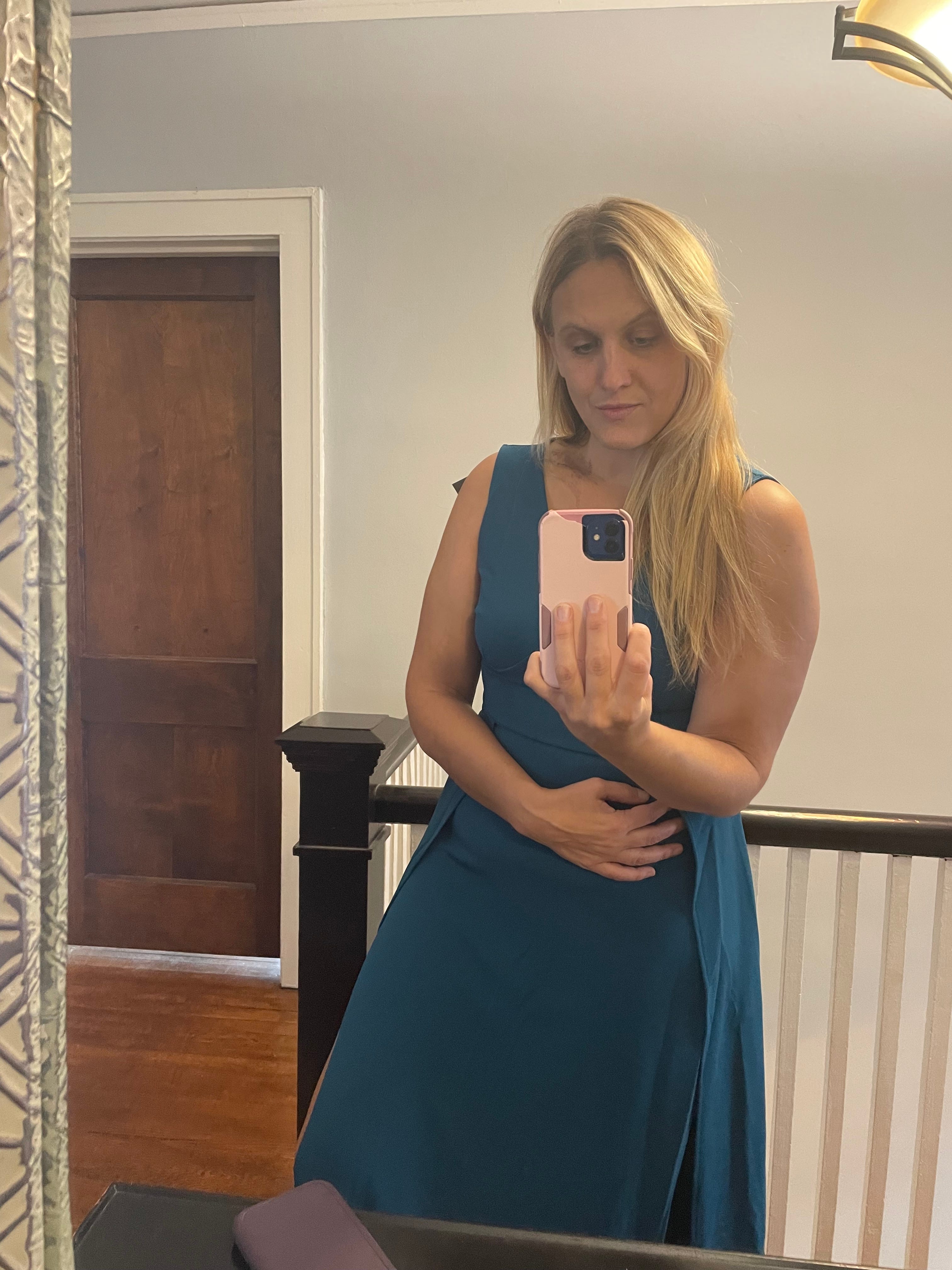 Does this dress flatter my purple boob? - by Sarah McCammon