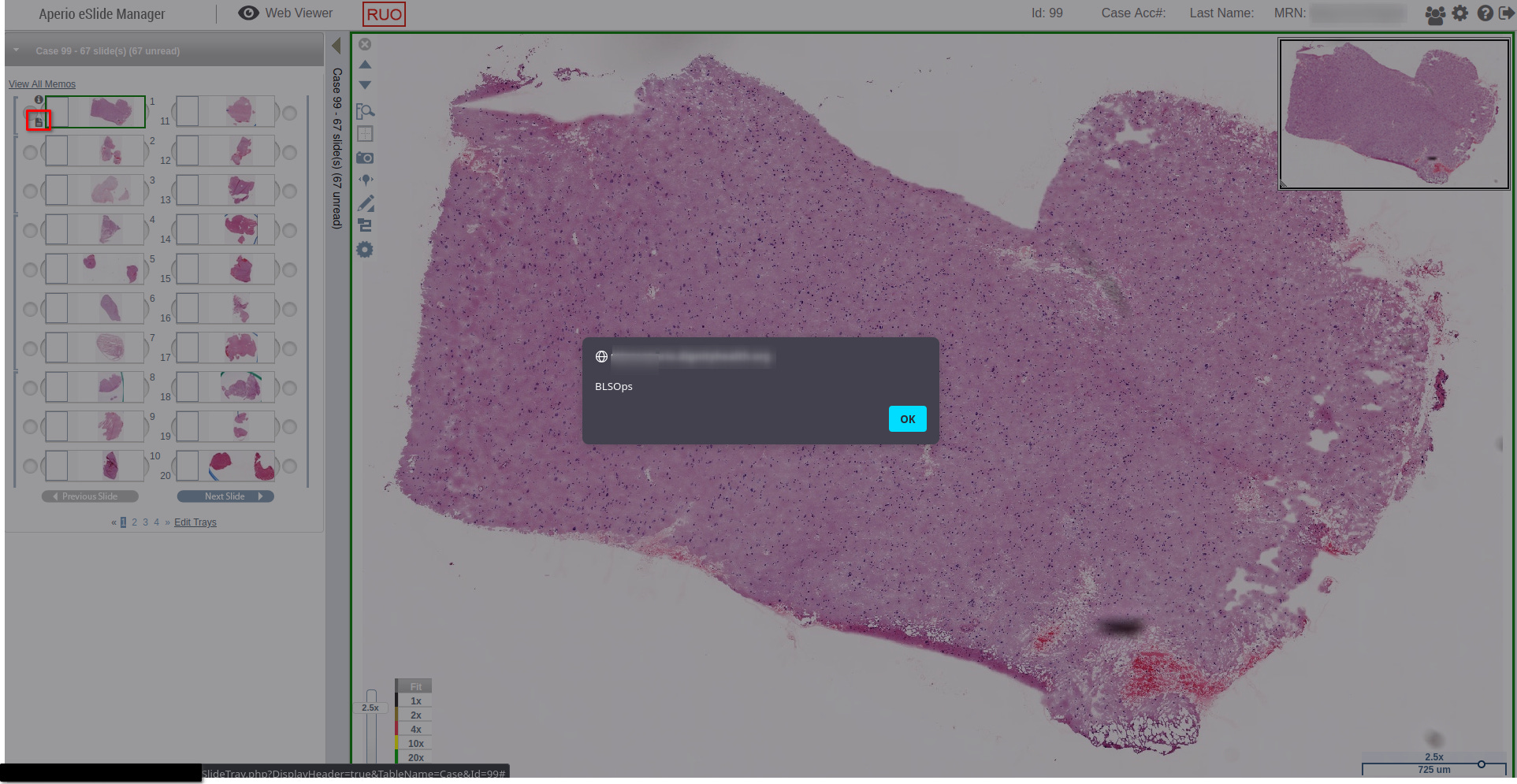 CVE-2025-1888—Reflected XSS in Aperio Eslide Manager