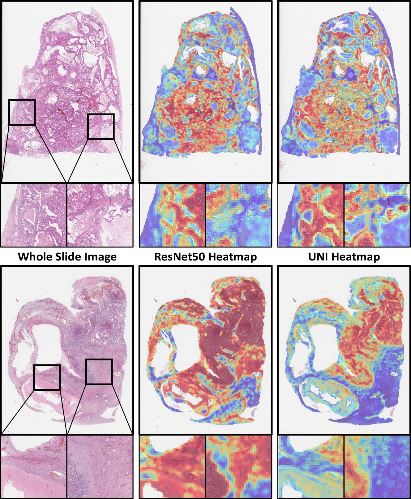 Histopathology & Foundation Models: How good are they really?