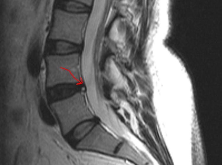 Case Study | 2. Excruciating Back Pain - by Remnant MD