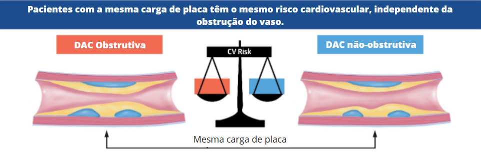 Doença arterial coronariana (DAC): como investigar