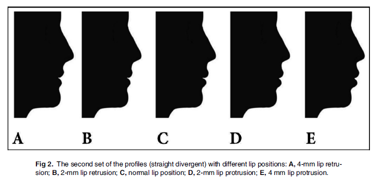 Esthetic Evaluation of Lip Position in Silhouette with Respect to ...