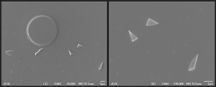 Electron Microscopy Of The Blood Of A 43 Year Old With 3 Pfizer ...