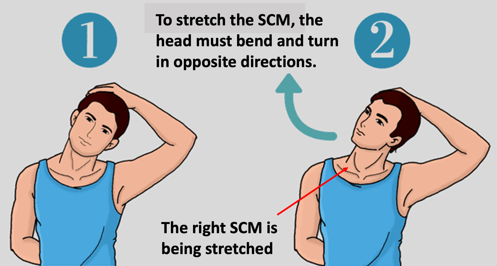 The Forgotten History of Carpal Tunnel Syndrome